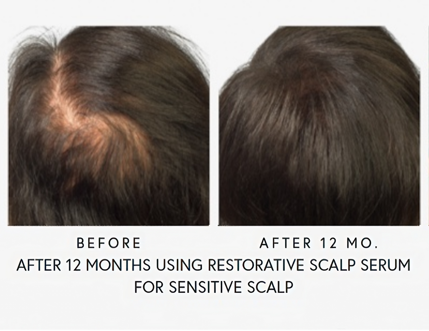 Hairapy Haircare • Hair Thickening & Scalp Care Products